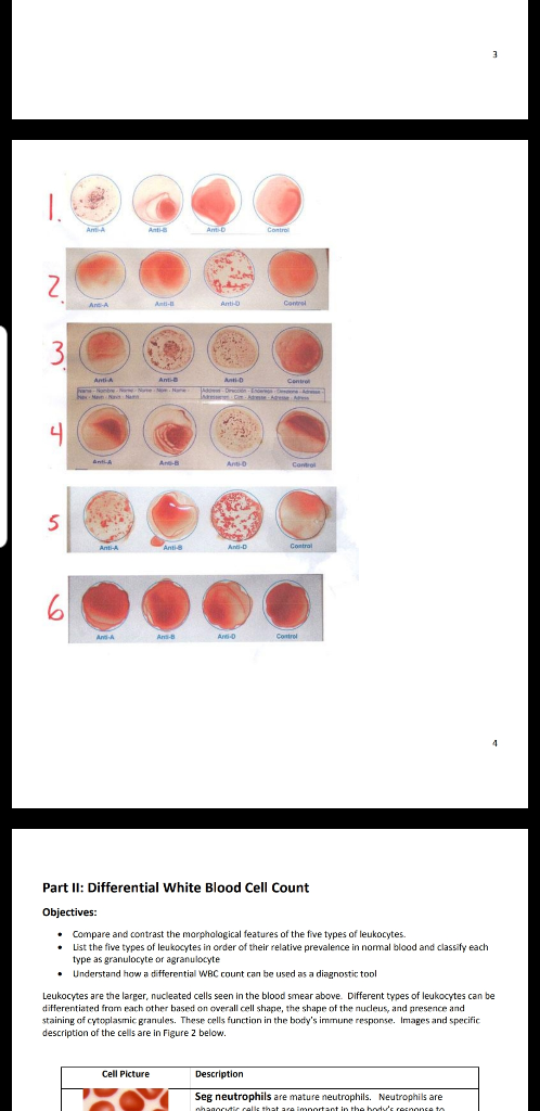 Solved What are the six blood types shown for each | Chegg.com