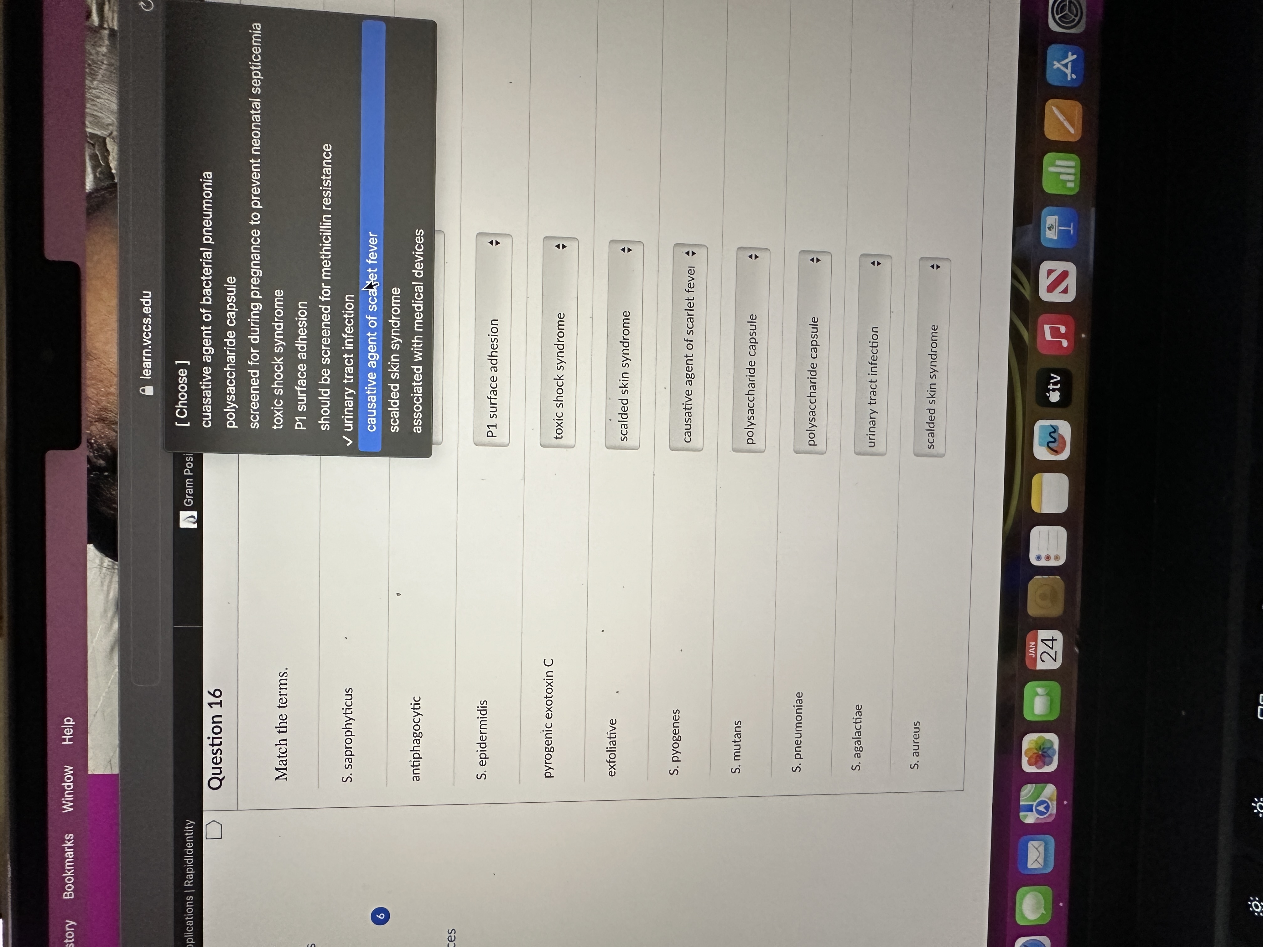 Solved [ ﻿Choose ]Question 16cuasative agent of bacterial | Chegg.com