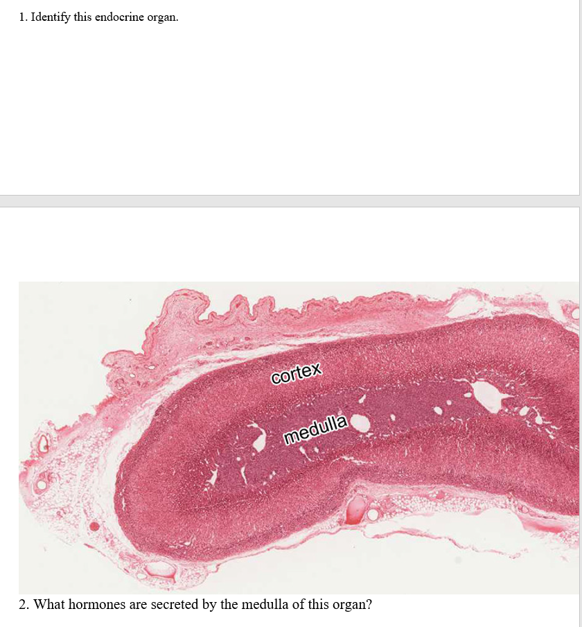 Solved Identify this endocrine organ.What hormones are | Chegg.com