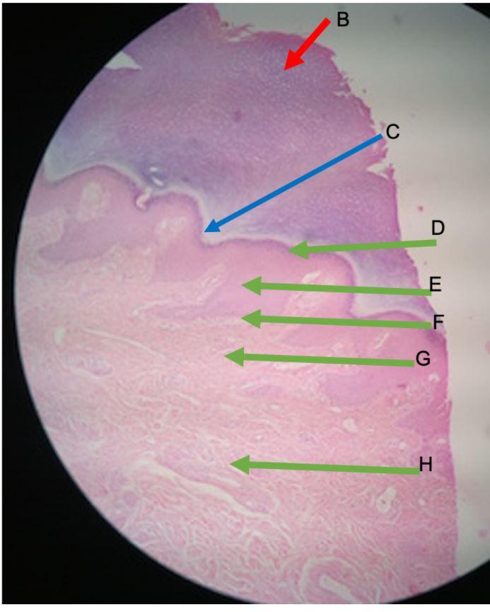 Solved a) Looking at the entire photomicrograph, what is the | Chegg.com