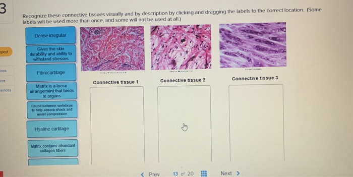 Solved Recognize these connective tissues visually and by | Chegg.com Solved Recognize these connective tissues visually and by | Chegg.com