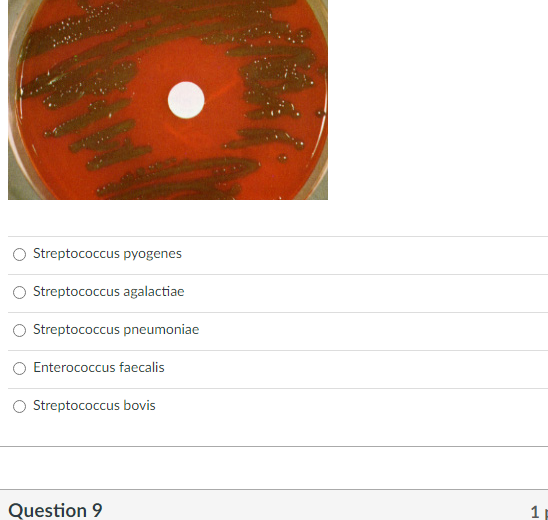 Solved Streptococcus pyogenes Streptococcus agalactiae | Chegg.com