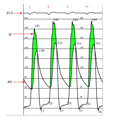 Solved Use the systolic and diastolic pressure waveform in | Chegg.com