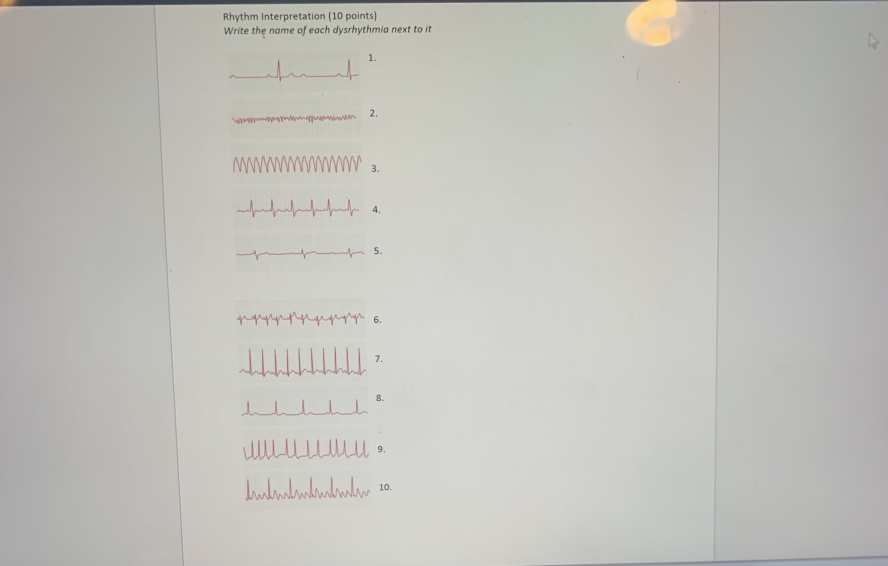 Solved Rhythm Interpretation (10 points) Write the name of | Chegg.com