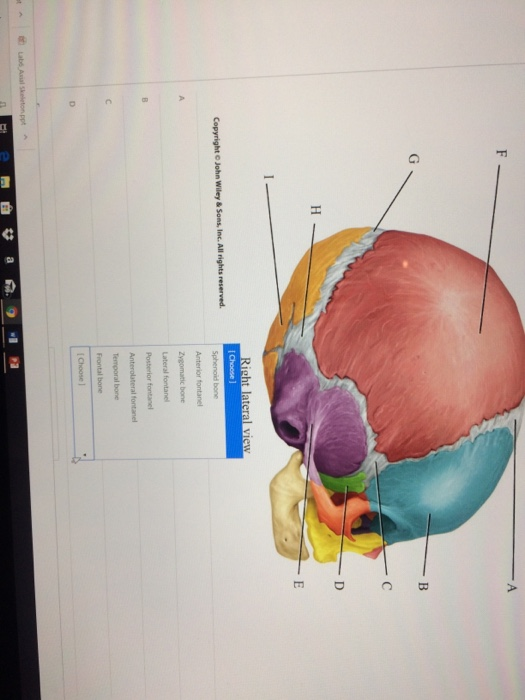 Solved Anterior fontanel Zygomatic bone Lateral fontanel | Chegg.com