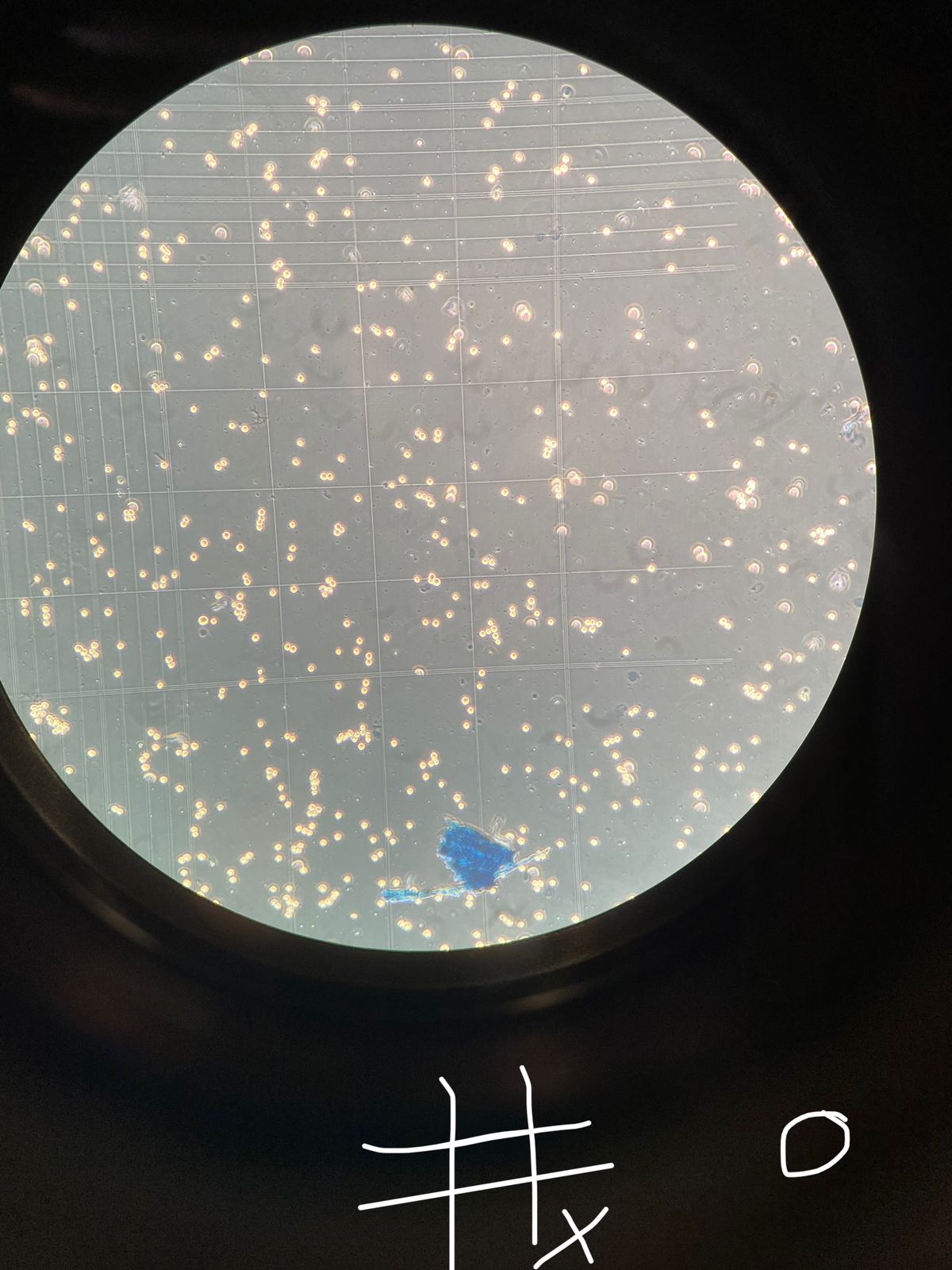 Solved Counting trypsinized cells (with 2.5% 0% (control) | Chegg.com