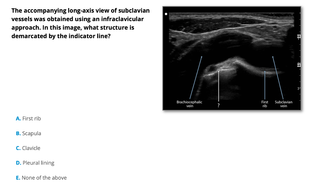 Solved Ultrasound-guided subclavian vein cannulation using | Chegg.com