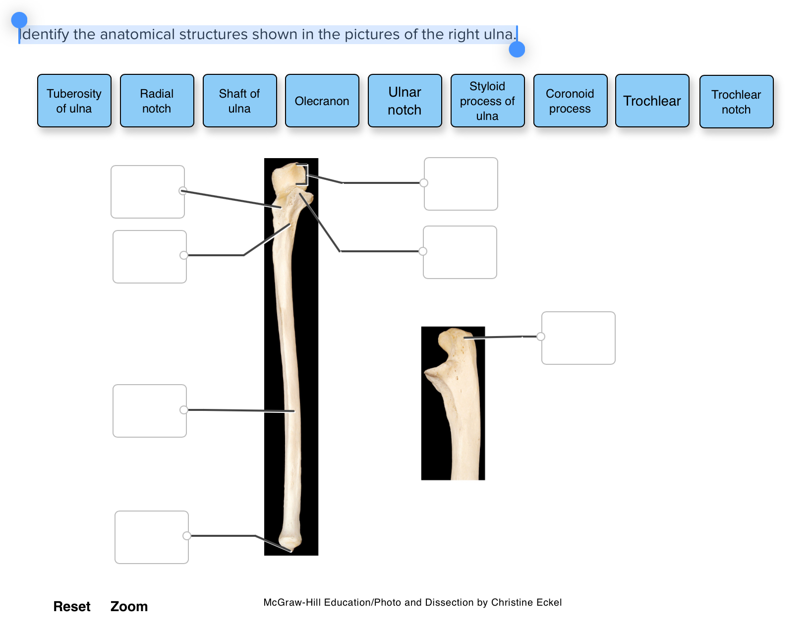 Solved identify the anatomical structures shown in the | Chegg.com