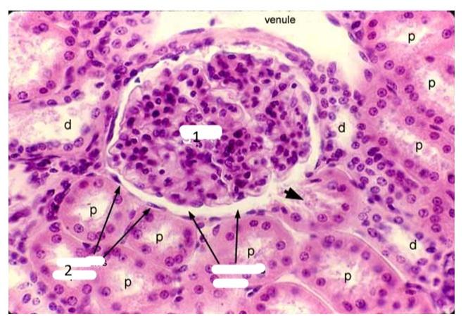 Solved A) Label using the terms: renal cortex, major calyx, | Chegg.com