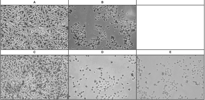 Solved Virus/serum mixtures were prepared as indicated | Chegg.com