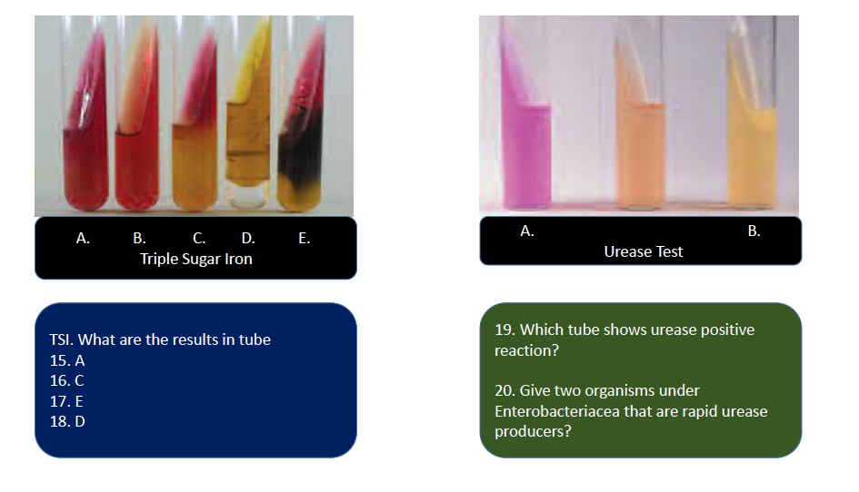 Solved A. C. B. A. E. B. D. Triple Sugar Iron Urease Test | Chegg.com