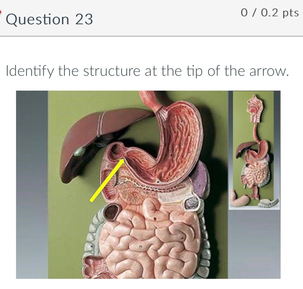 Solved Identify the structure at the tip of the | Chegg.com