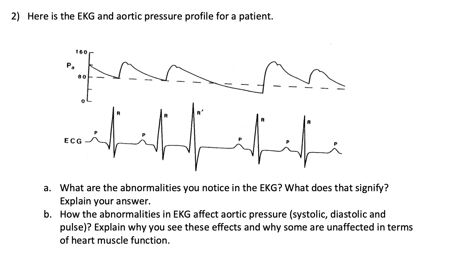 Solved Here is the EKG and aortic pressure profile for a | Chegg.com