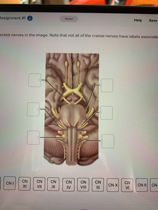 label the selected nerves in the image note that not | Chegg.com