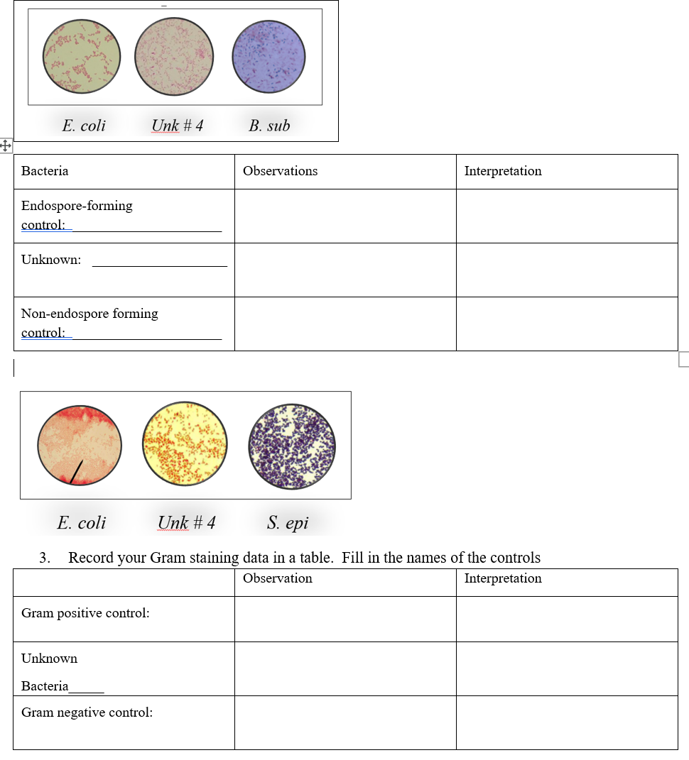 Solved E. coli Unk \# 4 S. epi 3. Record your Gram staining | Chegg.com
