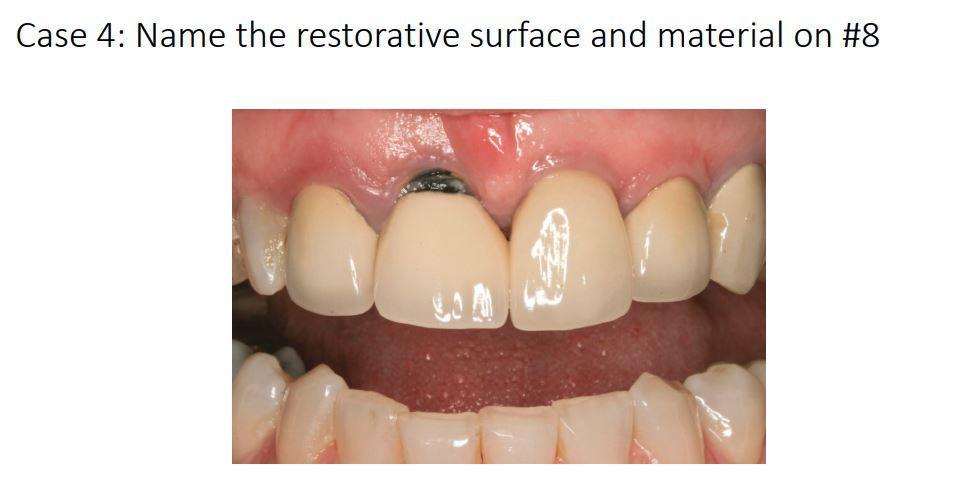 Solved Case 3: Name the filling surface and material on | Chegg.com
