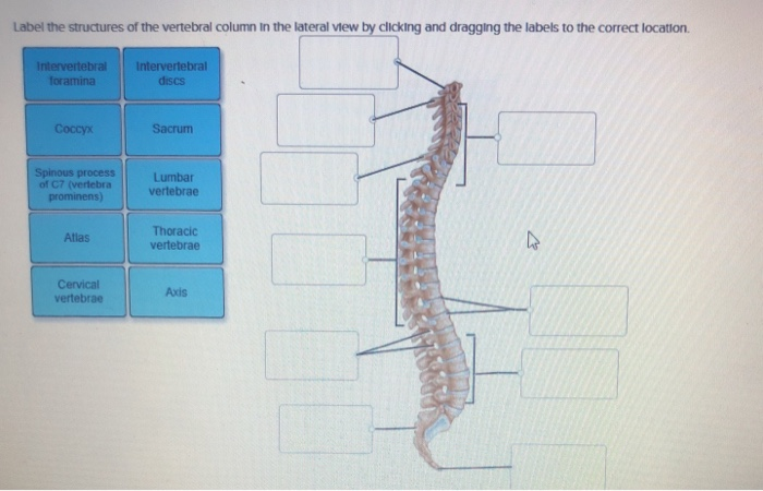 Solved Label the structures of the vertebral column in the | Chegg.com