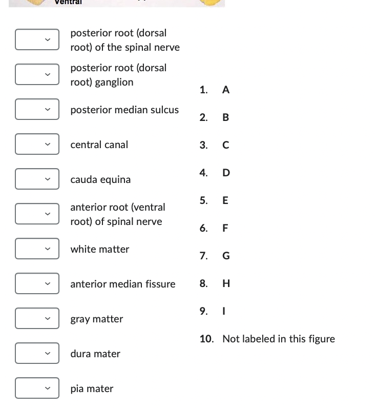 Solved Match the name of the features in the micrograph of a | Chegg.com