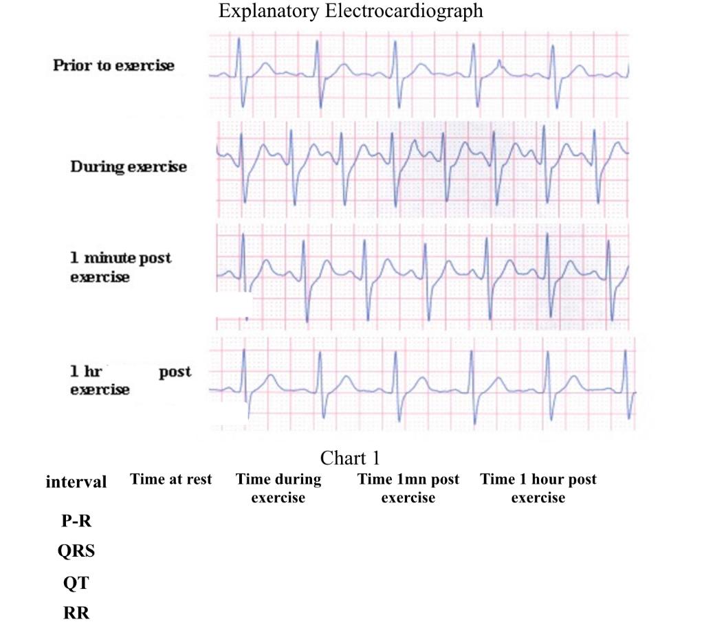 Solved Explanatory Electrocardiograph Prior to exercise | Chegg.com