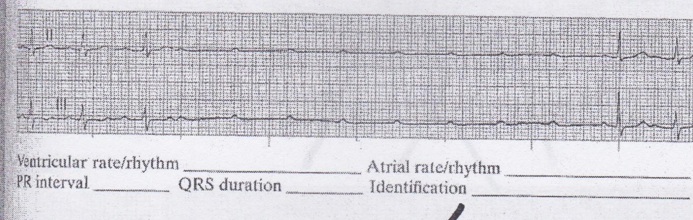 Solved What is the PRI:, Vent rate/rhythm, QRS Interval and | Chegg.com