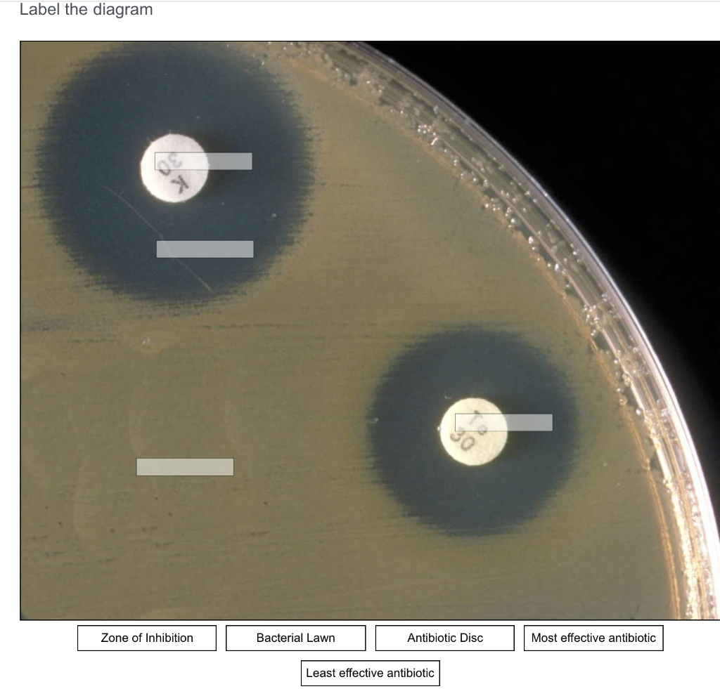 Solved Label the diagram Zone of Inhibition Bacterial Lawn | Chegg.com
