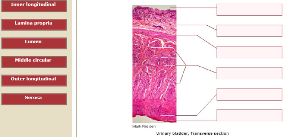 Solved Inner longitudinal Lamina propria Lumen Middle | Chegg.com