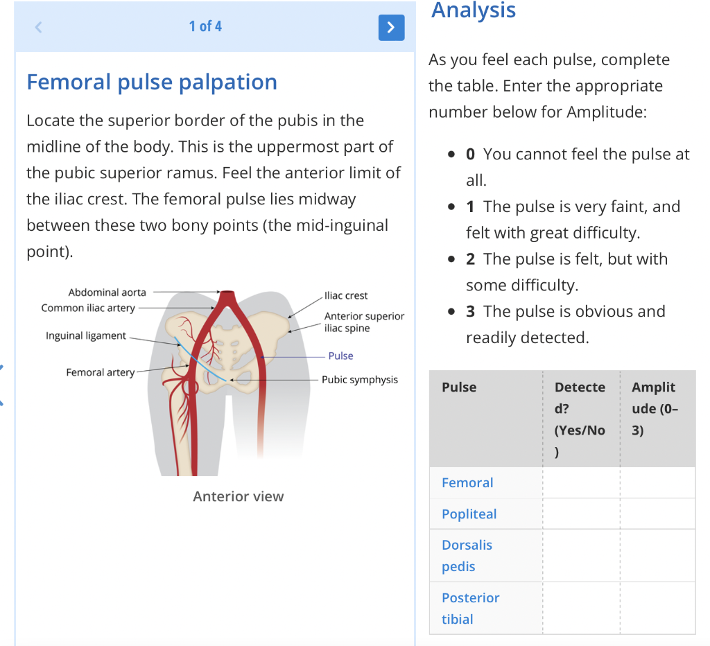 Femoral Pulse Palpation