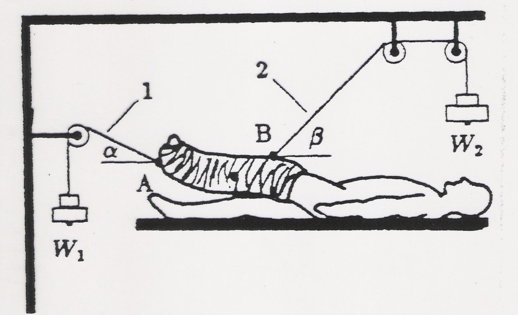 Solved Scenario: patient with tibia fracture in traction bed | Chegg.com