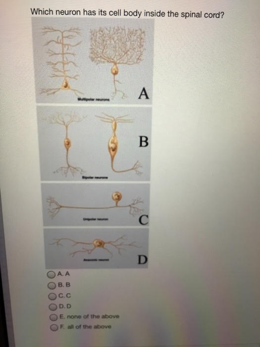 Solved Which neuron has its cell body inside the spinal | Chegg.com