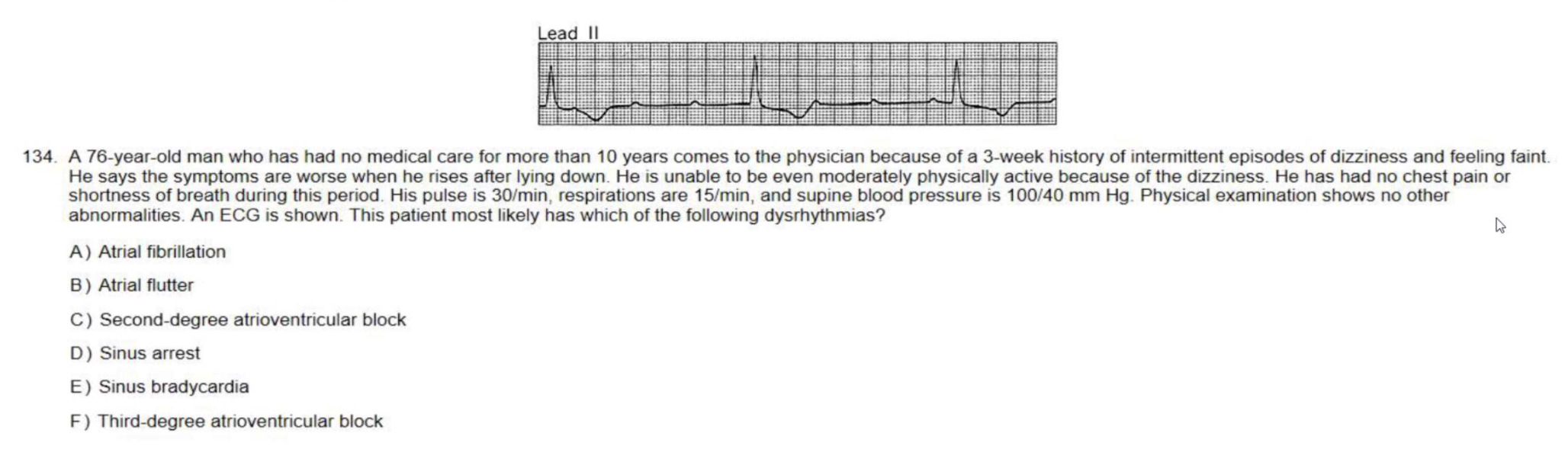 Solved abnormalities. An ECG is shown. This patient most | Chegg.com