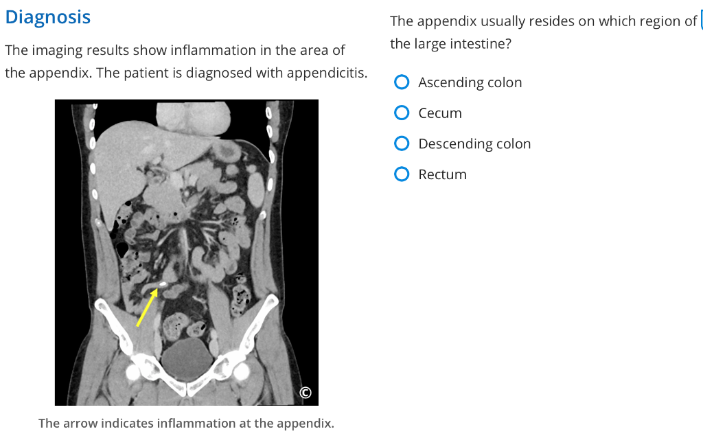 Solved Place the following segments of the large intestine | Chegg.com