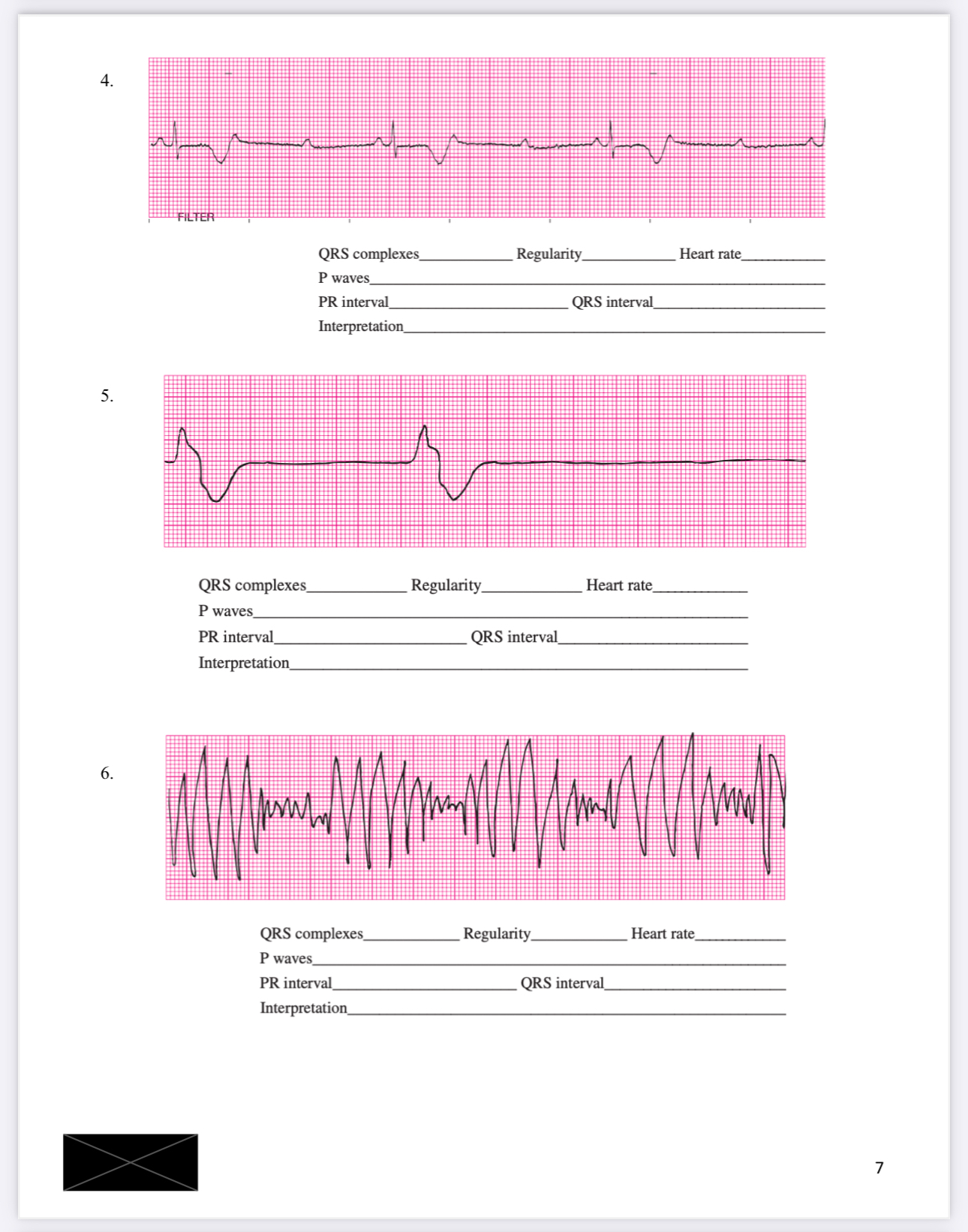 Solved Identify the QRS complexes, regularity, ﻿heart rate, | Chegg.com