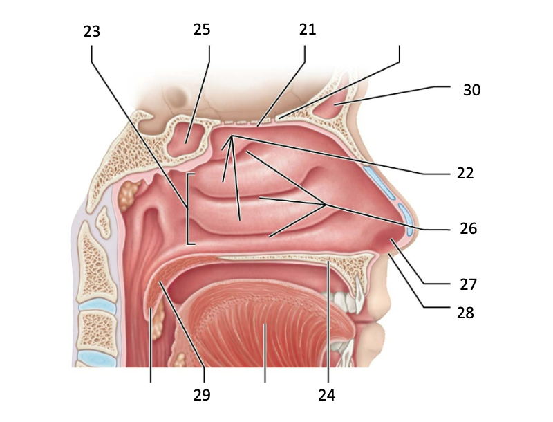 Solved Please identify all structures | Chegg.com