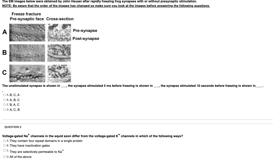 Solved The EM images below were obtained by John Heuser | Chegg.com