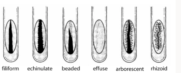 Solved Background for Microbial Growth on Slants and Broths | Chegg.com