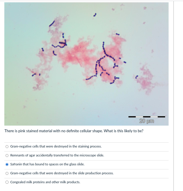 Solved There is pink stained material with no definite | Chegg.com