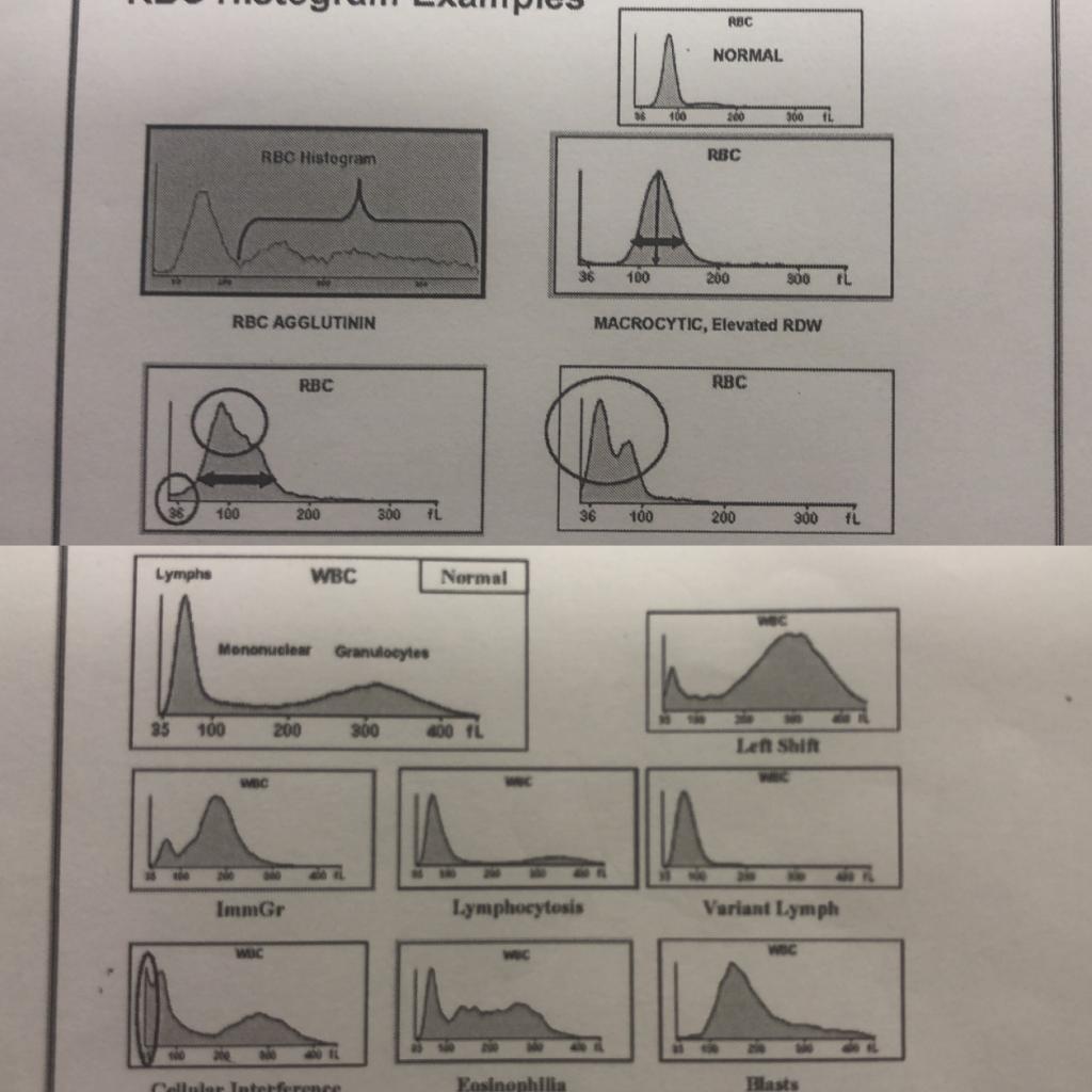 Solved Can you interpret the RBC and WBC histogram (normal, | Chegg.com