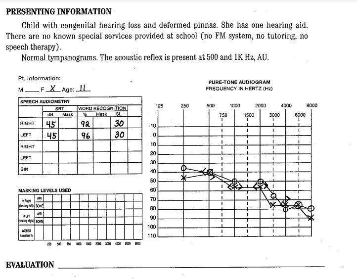 Interpret the attached audiogram, including the | Chegg.com