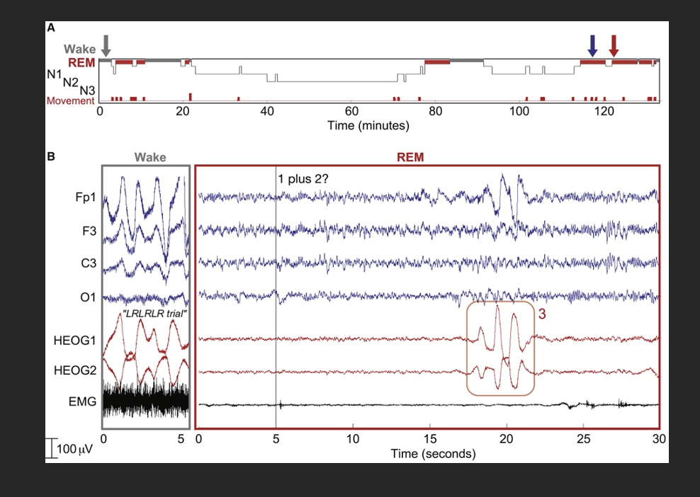 Solved The above picture depicts EEG signals (in blue) and | Chegg.com