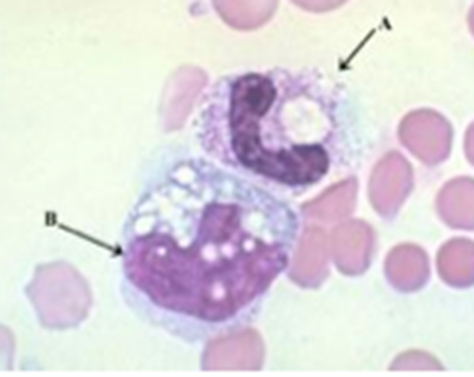 Solved B | Chegg.com