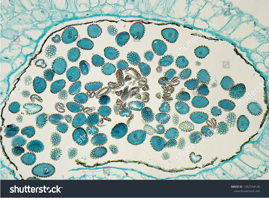 Solved Observe Pollen Samples 1 and 2. Compare and contrast | Chegg.com