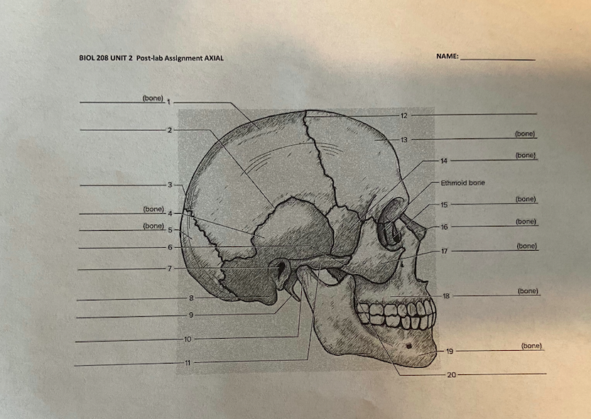 Solved (bone) 7 (bone) 2 8 (bone) bonell bone) 3 9 | Chegg.com