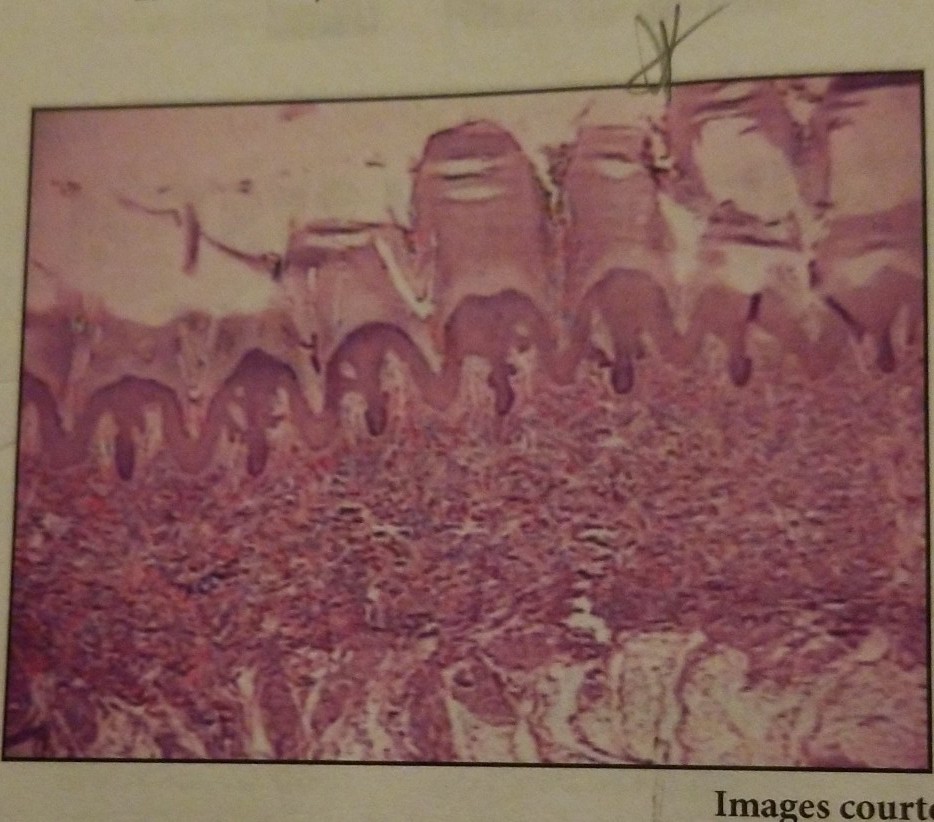 Solved Identify( label) the dermis epidermis and | Chegg.com Solved Identify( label) the dermis epidermis and | Chegg.com