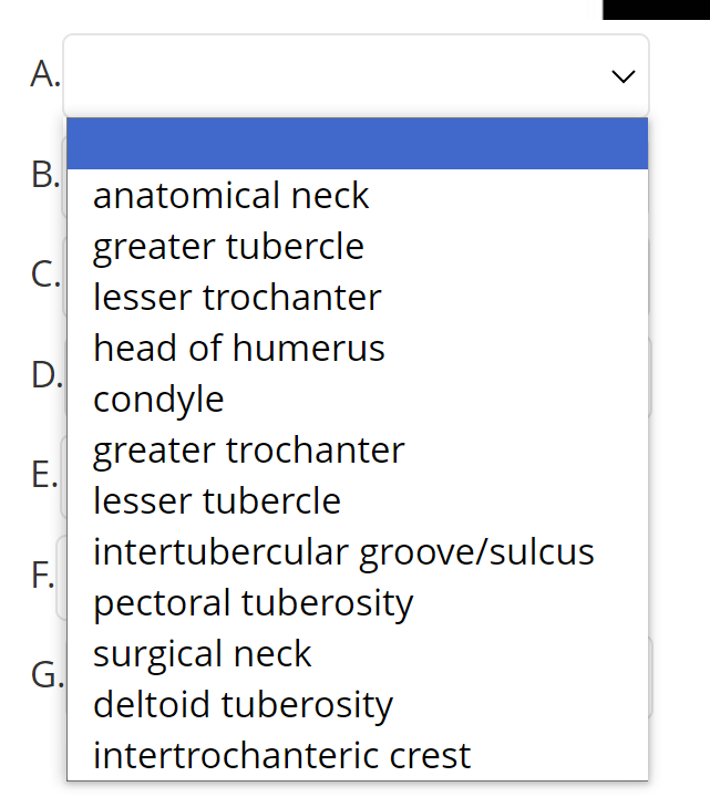 Solved Using the drop boxes below, identify the following | Chegg.com