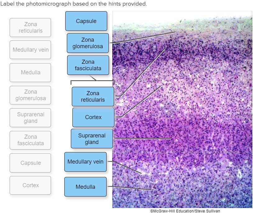 Solved: Label The Photomicrograph Based On The Hints Provi... | Chegg.com