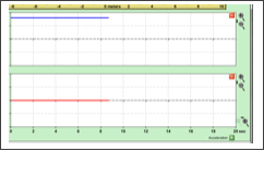 Moving Man Simulation16. Draw an example of The | Chegg.com