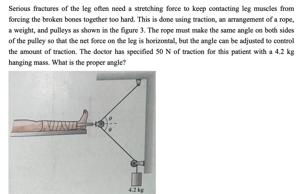 Solved Serious Fractures Of The Leg Often Need A Stretching Chegg solved-serious-fractures-of-the-leg-often-need-a-stretching-chegg