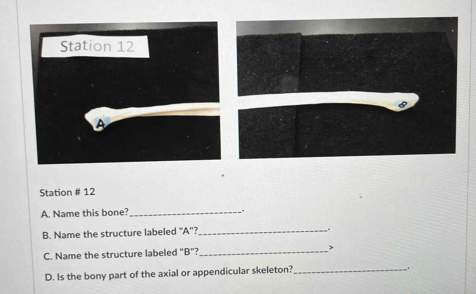 Solved A. Name this bone? B. Name the structure labeled "A"? | Chegg.com
