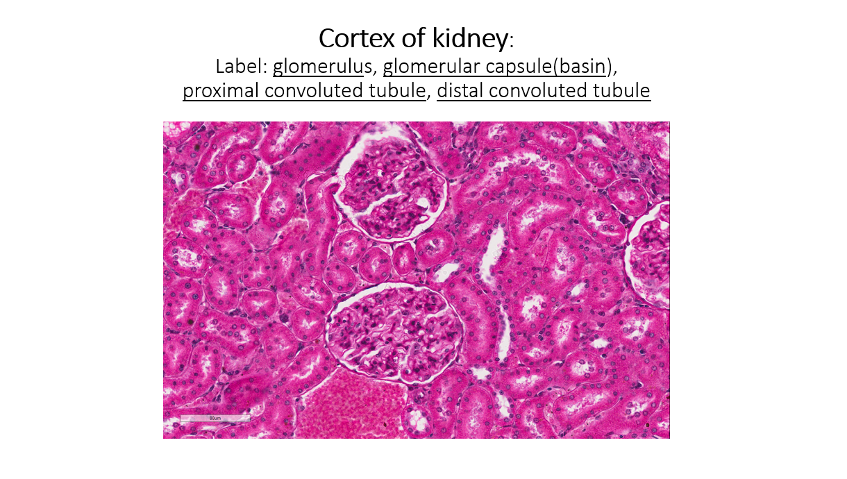 Solved Cortex of kidney: Label: glomerulus, glomerular | Chegg.com