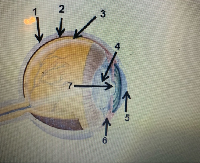 Solved is the solution that fills the chamber labeled 15. 18 | Chegg.com